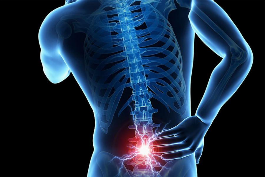 Coccyx pain: causes and treatment - BackPainSources