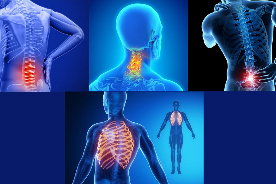 Types of back pain - BackPainSources